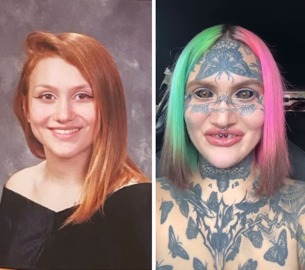 Influencer polemiza ao mostrar antes e depois de modificações corporais ...