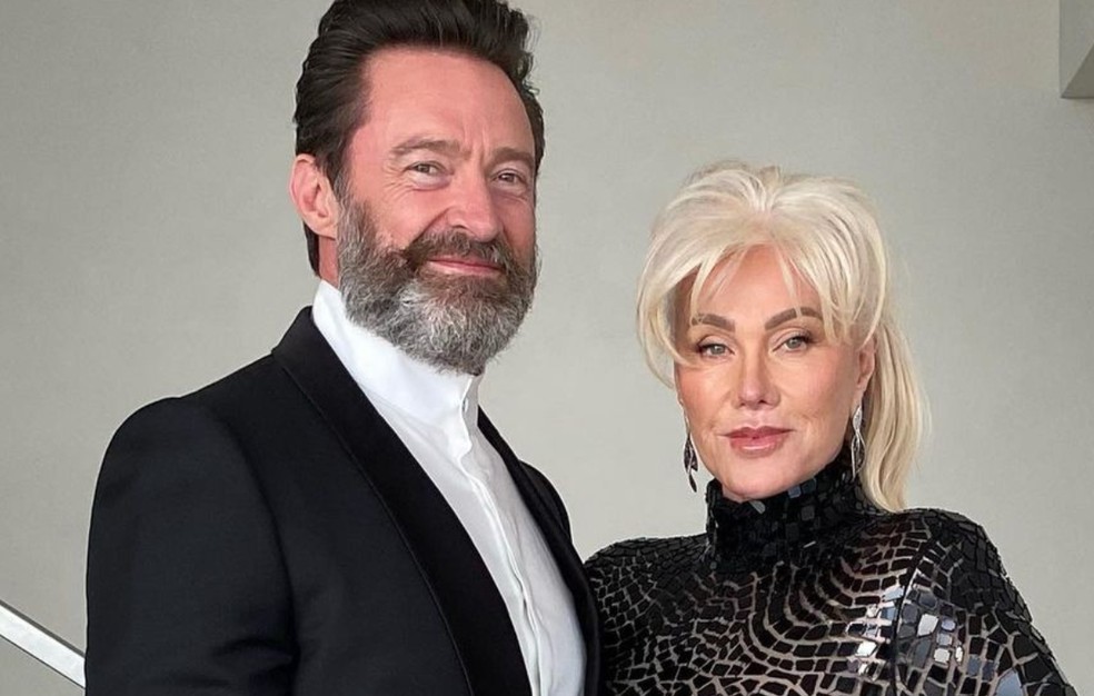 Transformacao De Hugh Jackman Diego Hypolito Exibe Mudanças No Rosto
