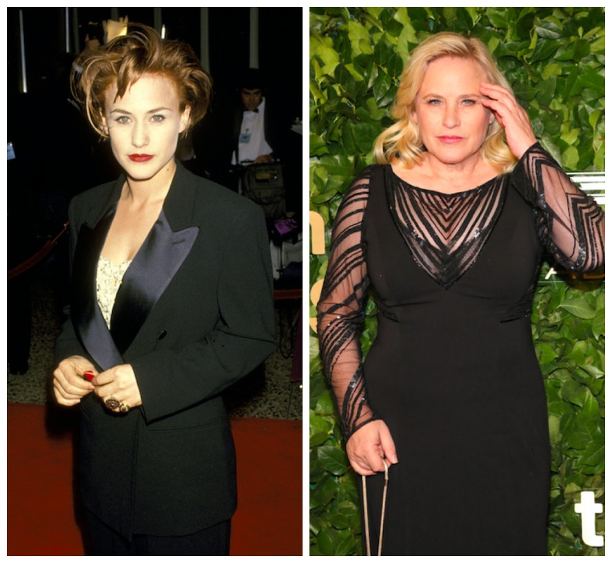 Patrícia Arquette, aos 54 anos, admite que pode fazer plástica por ...