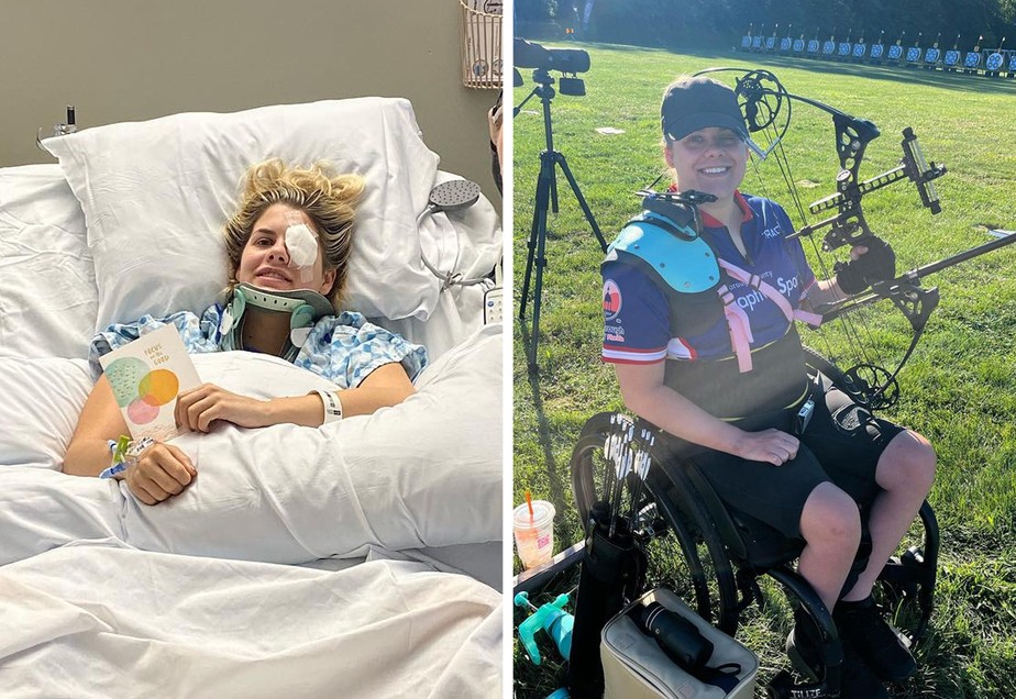 Mulher se torna atleta paralímpica após ser agredida por ex ciumento e ...