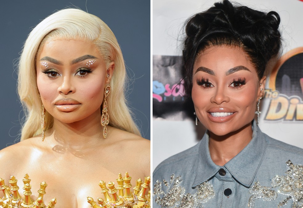 Ex-cunhada das Kardashians comemora retirada de preenchimentos ilegais no bumbum: 'Não avisam ...