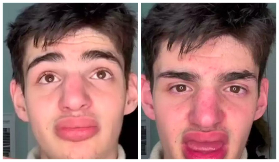 Adolescente viraliza ao dizer que descobriu que seu melhor amigo há 10 ...