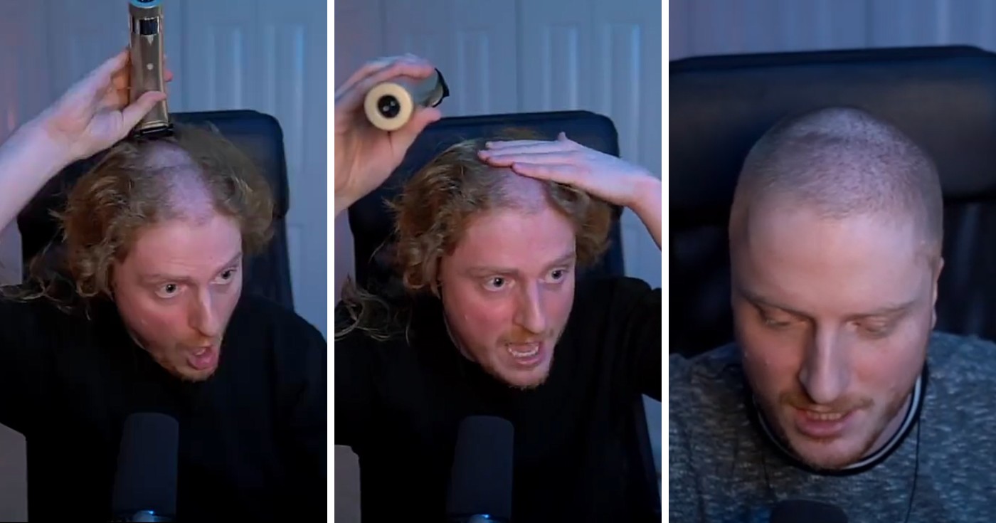 Streamer viraliza ao raspar cabelo e descobrir cabeça deformada por uso ...