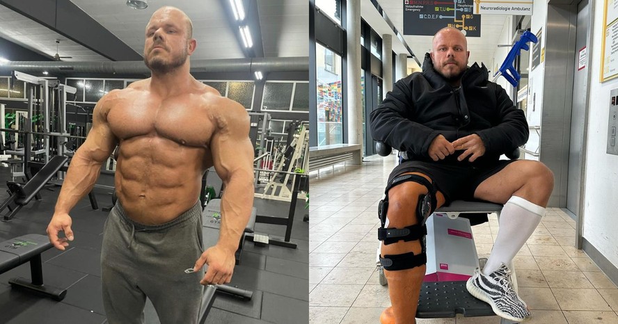 Fisiculturista morre aos 31 anos após cirurgia no joelho e causa comoção