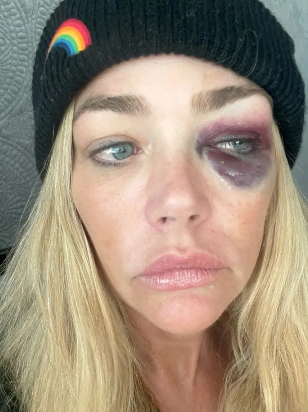 Vídeo de reality show com marido ameaçando esmagar a mão de Denise ...