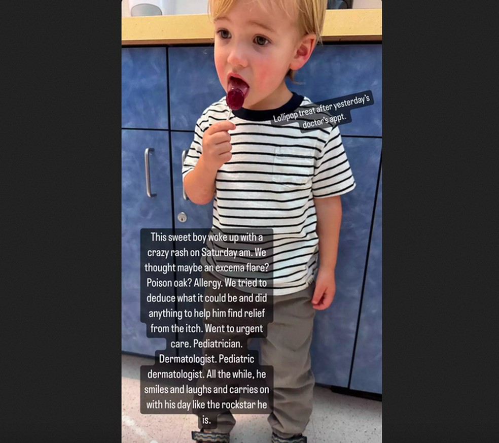 Mandy Moore, estrela de 'This Is Us', revela doença rara de pele do ...