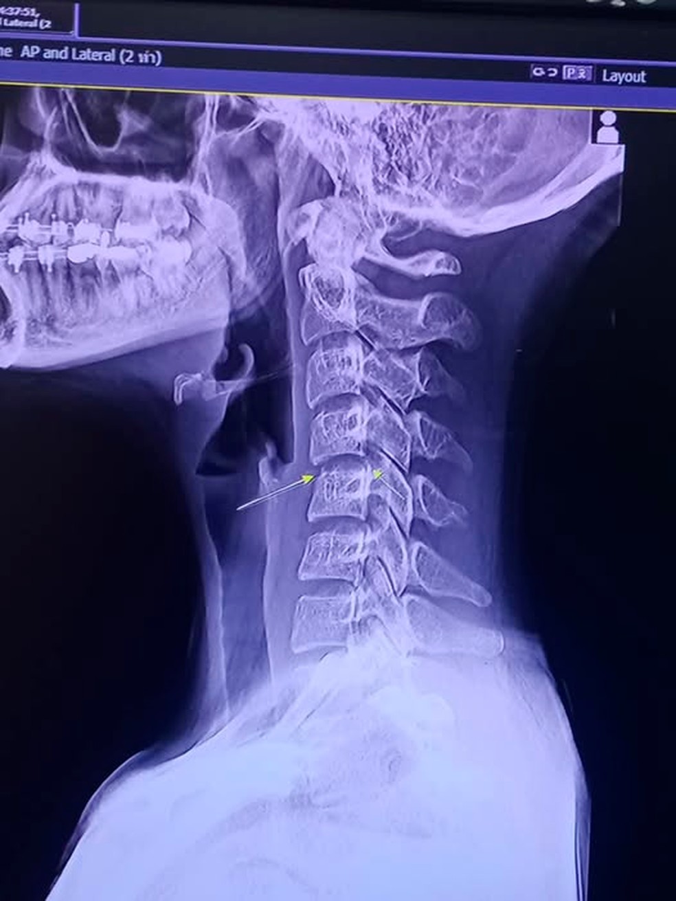 Morte misteriosa de cantora na Tailândia desencadeia guerra de versões ...