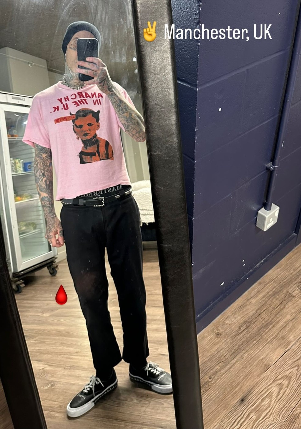 Travis Barker assusta fãs com foto chocante de dedos em carne viva após ...