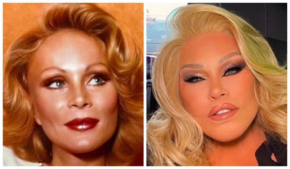 Jocelyne Wildenstein, a Mulher Gato recordista de plásticas, deixou reality show sobre sua vida ...