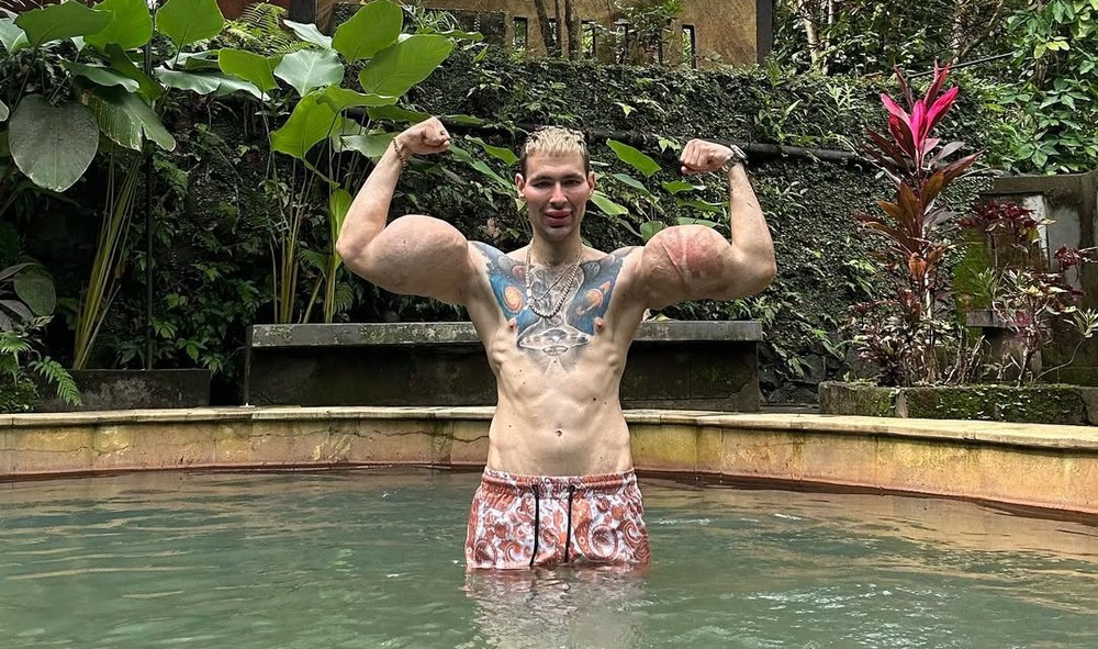 'Popeye Russo', influencer famoso pelos músculos ‘impossíveis’, é ...