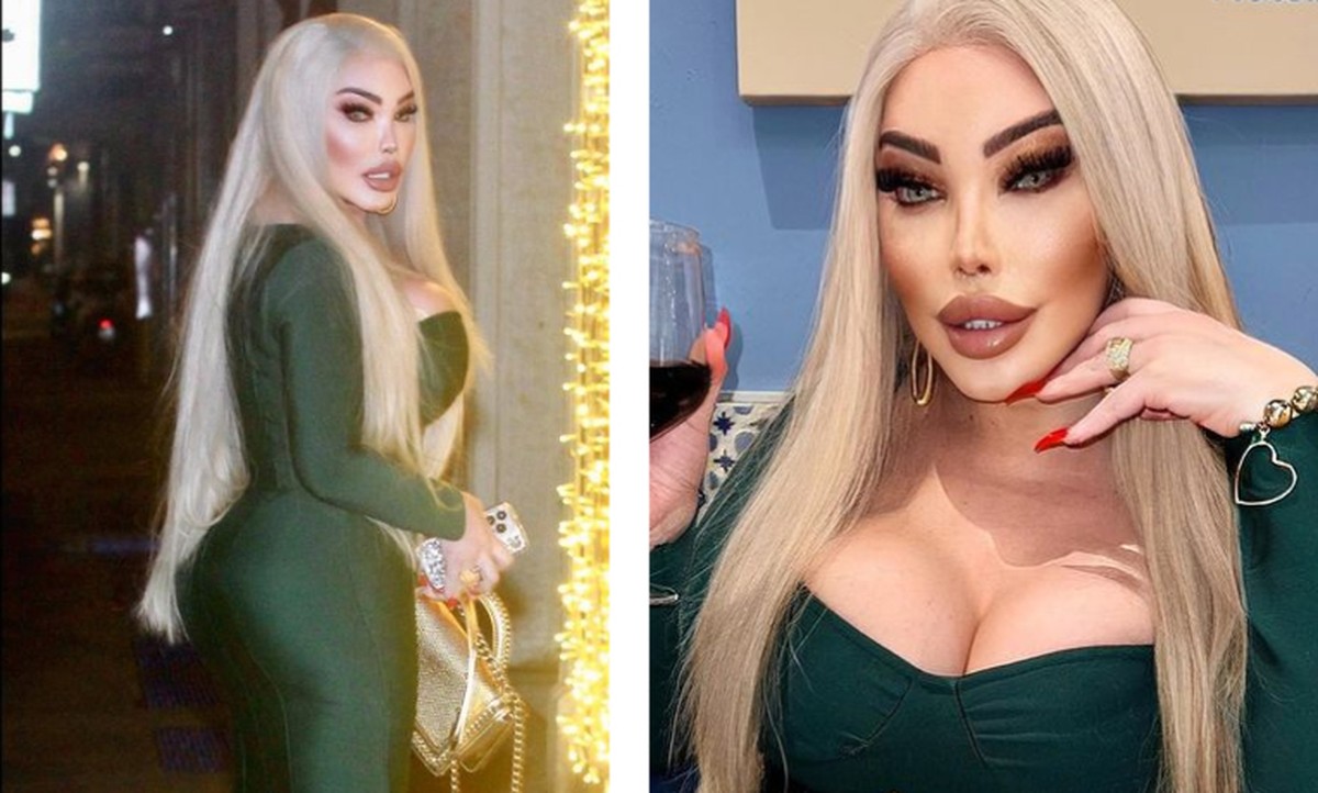 Jessica Alves Diz Que Vai Passar Natal Em Clínica Após Implantes No