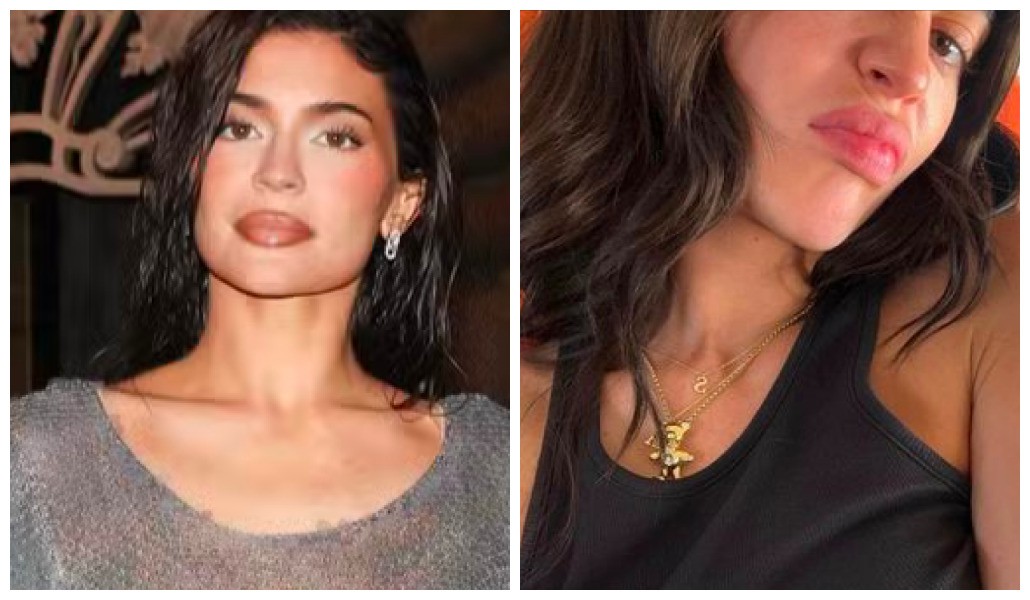 Kylie Jenner ressurge 'irreconhecível' após remover metade de ...