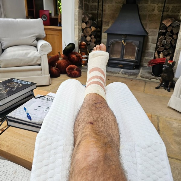 Henry Cavill mostra perna machucada em acidente que adiou filmagens de ...