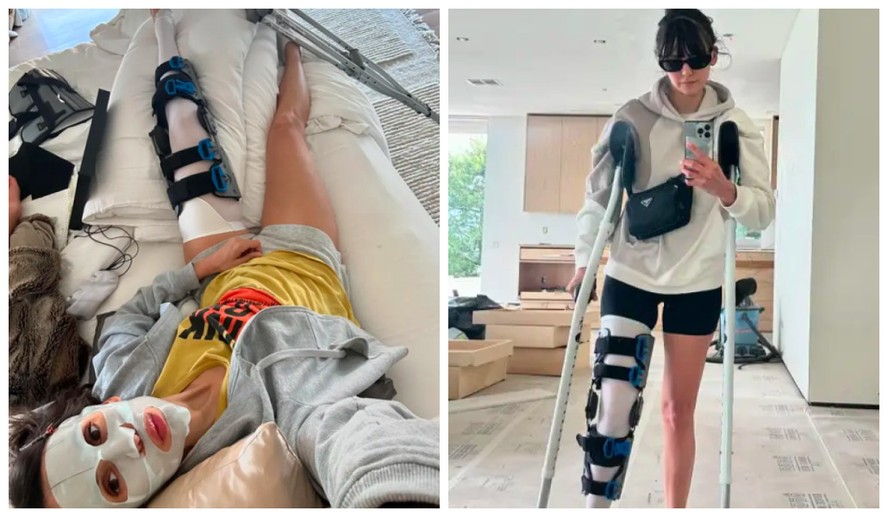 Nina Dobrev choca fãs ao mostrar perna imobilizada e muletas após ...