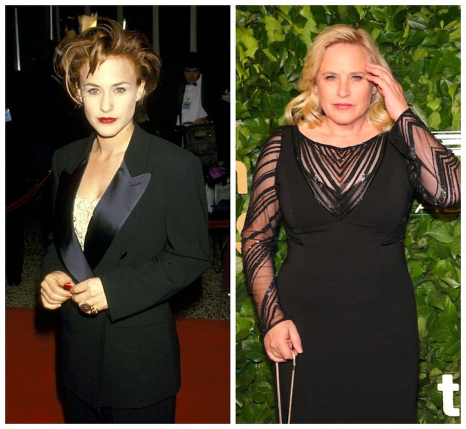 Patrícia Arquette, aos 54 anos, admite que pode fazer plástica por ...