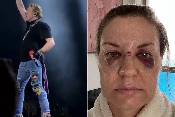 Axl Rose arremessa microfone para plateia e atinge rosto de fã durante ...