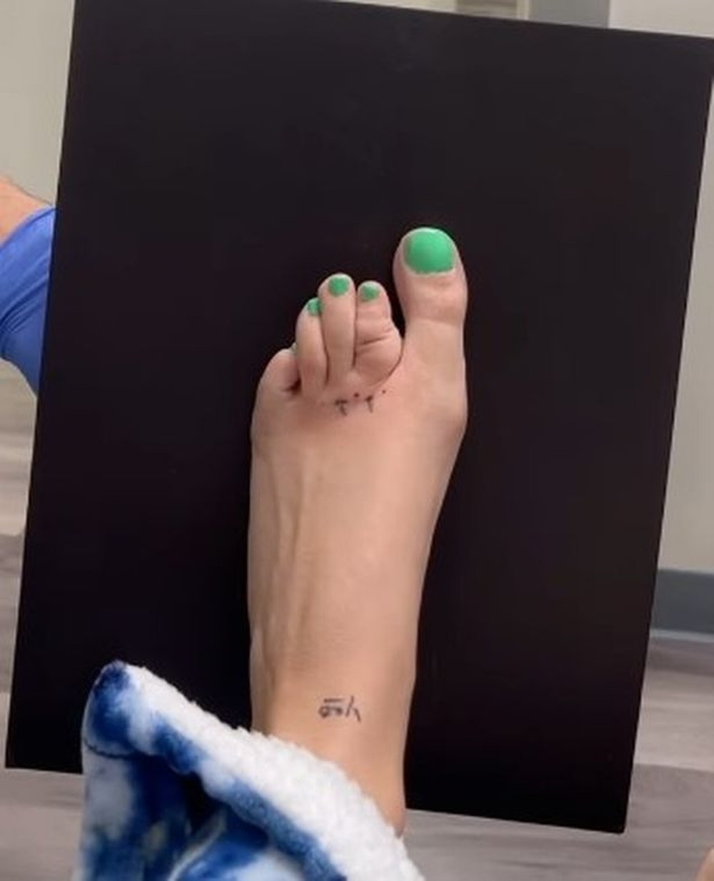 Estrela do hip-hop choca seguidores com fotos de 'antes e depois' de ...