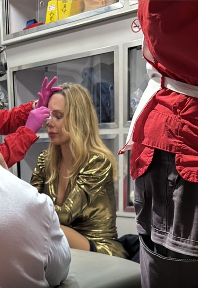 Influencer brasileira é atacada por cachorro no México e tem ponta do nariz arrancada: 'Achei ...