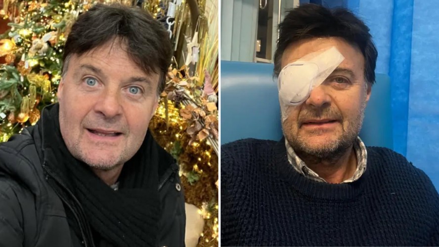 Ator fica cego de um olho após sofrer ataque aleatório: '15 segundos de ...