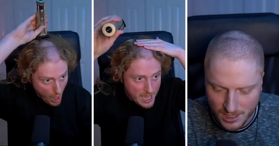 Streamer viraliza ao raspar cabelo e descobrir cabeça deformada por uso ...