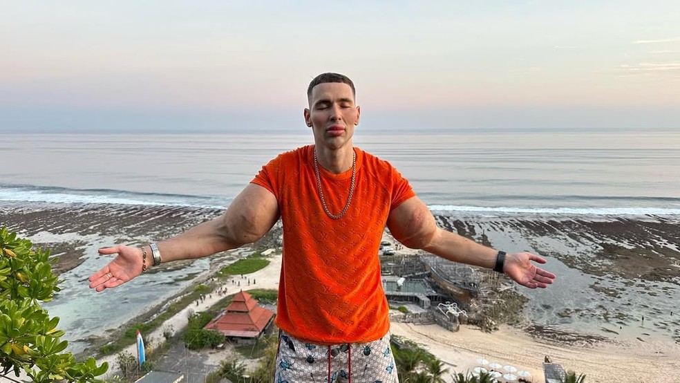 'Popeye Russo', influencer famoso pelos músculos ‘impossíveis’, é ...