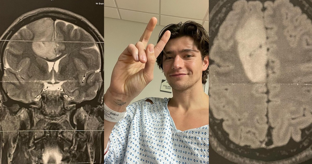 Astro de série revela tumor no cérebro aos 31 anos e comove fãs e artistas