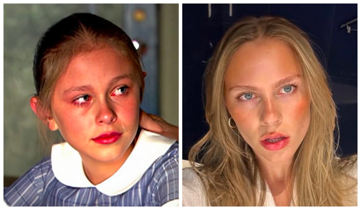 Ex-atriz mirim revela diagnóstico de câncer cerebral aos 25 anos