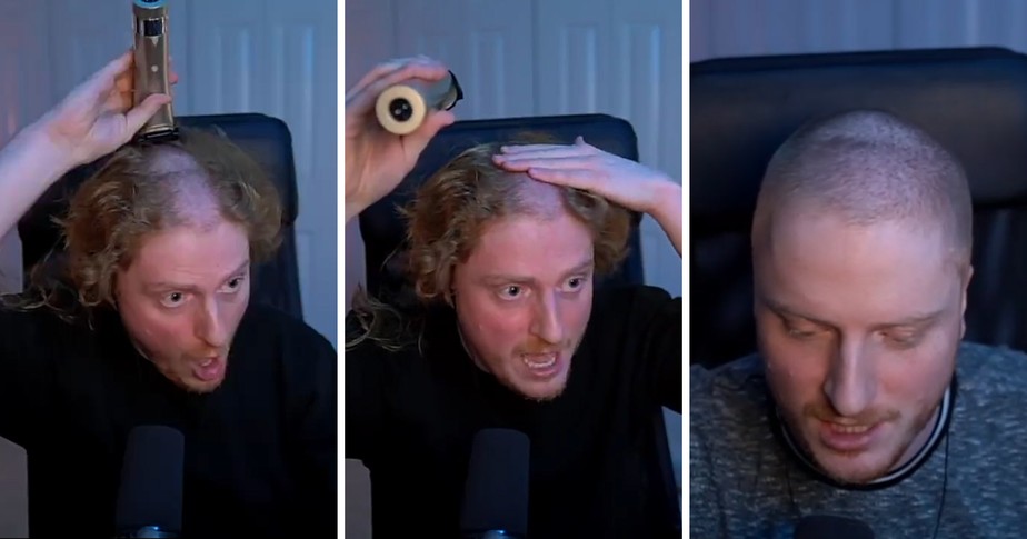 Streamer viraliza ao raspar cabelo e descobrir cabeça deformada por uso ...