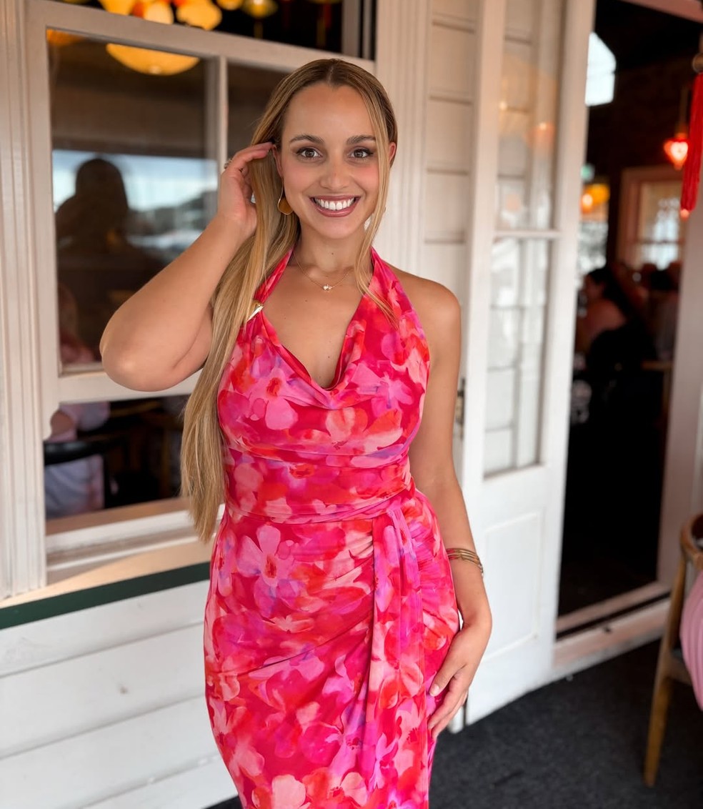 Repórter é atacada por pássaro durante gravação e mostra estrago: 'A ...