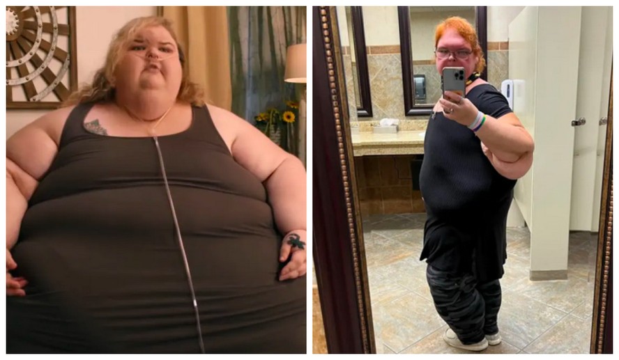 Estrela de reality sobre obesidade mórbida impressiona internet com perda de 226 kg e posa com ...