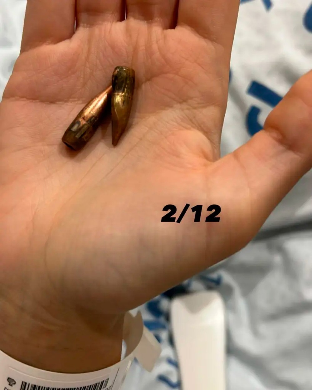 Militar israelense conta como sobreviveu milagrosamente após levar 12 ...