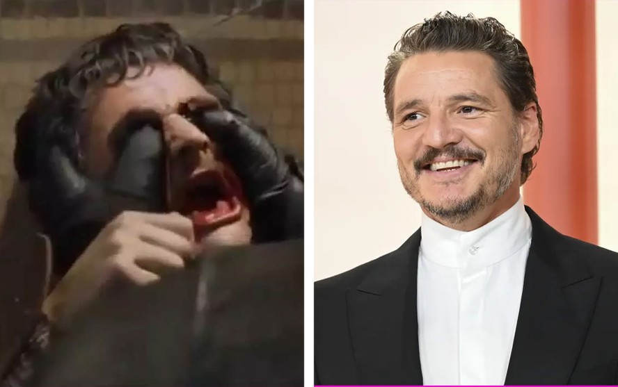 Pedro Pascal revela que pegou infecção nos olhos ao deixar fãs ...