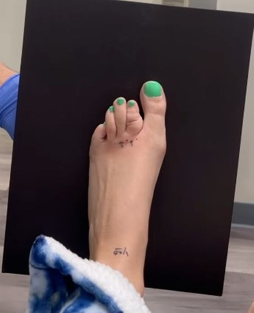 Estrela do hip-hop choca seguidores com fotos de 'antes e depois' de ...