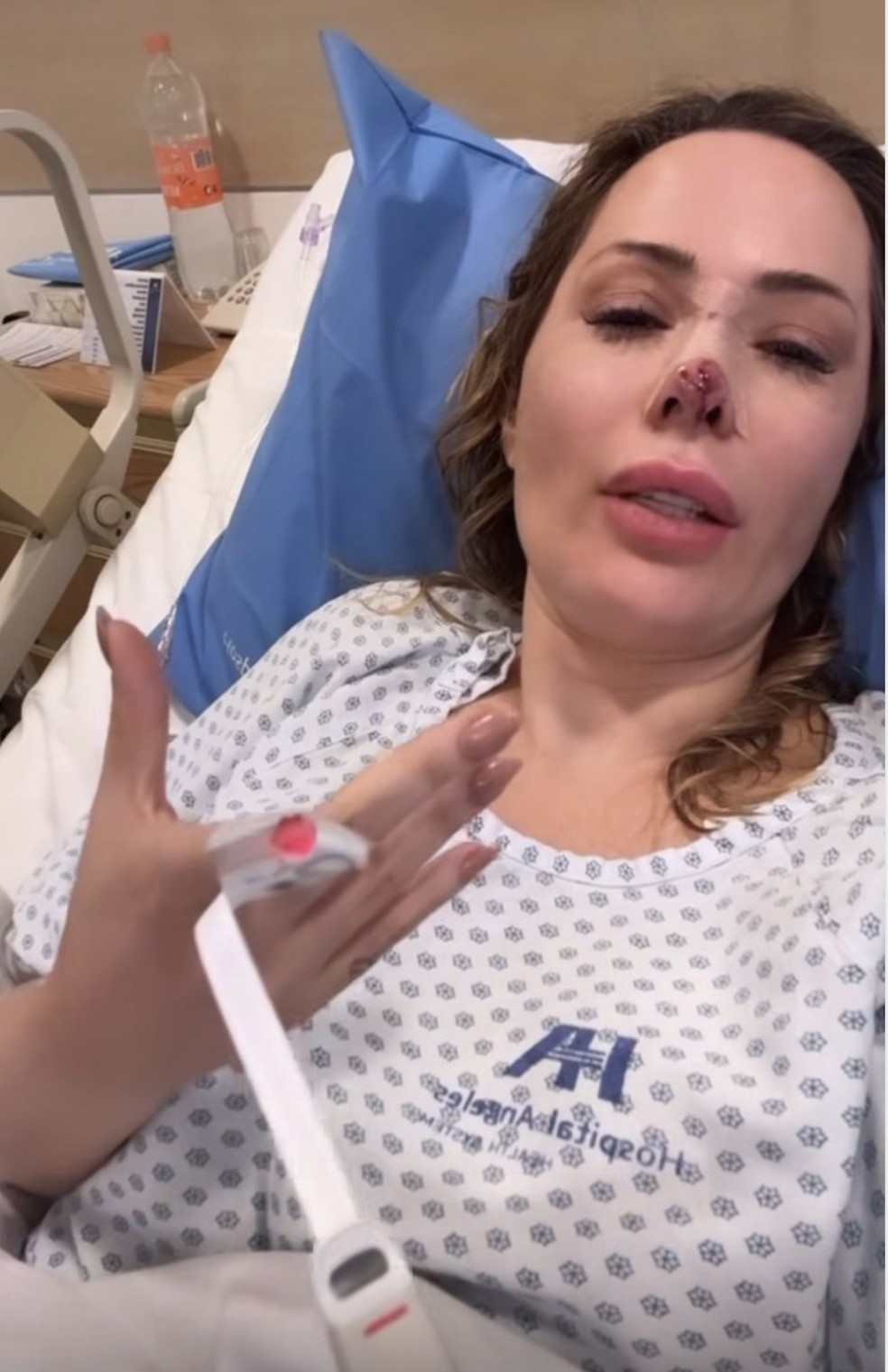 Influencer brasileira é atacada por cachorro no México e tem ponta do nariz arrancada: 'Achei ...