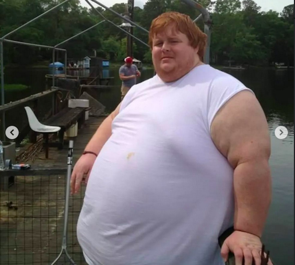 Astro de reality show sobre obesidade impressiona ao mostrar perda de ...