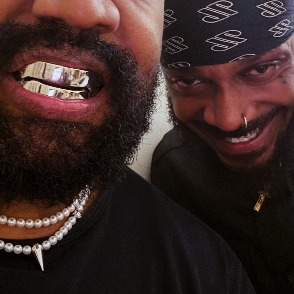 'Caroço' no lábio de Kanye West após prótese dentária de R$ 4,2 milhões ...