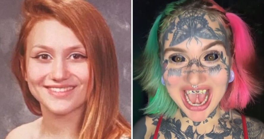 Influencer polemiza ao mostrar antes e depois de modificações corporais ...