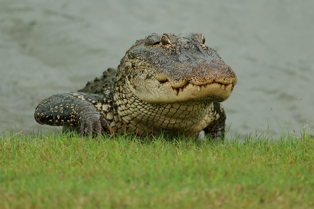 Jovem de 15 anos mostra cicatriz gigante na perna como troféu após ...