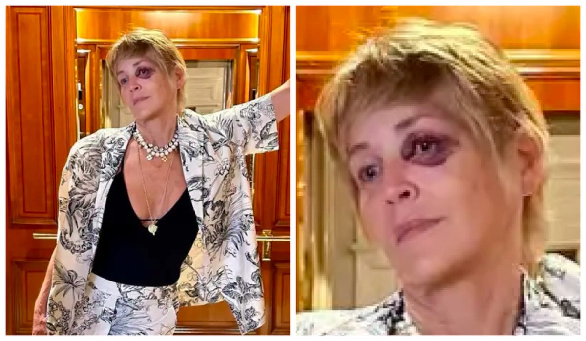 Sharon Stone choca fãs ao mostrar olho roxo durante férias na Turquia ...