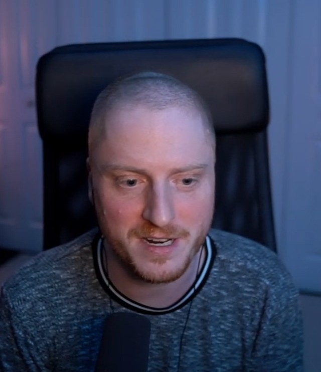 Streamer viraliza ao raspar cabelo e descobrir cabeça deformada por uso ...