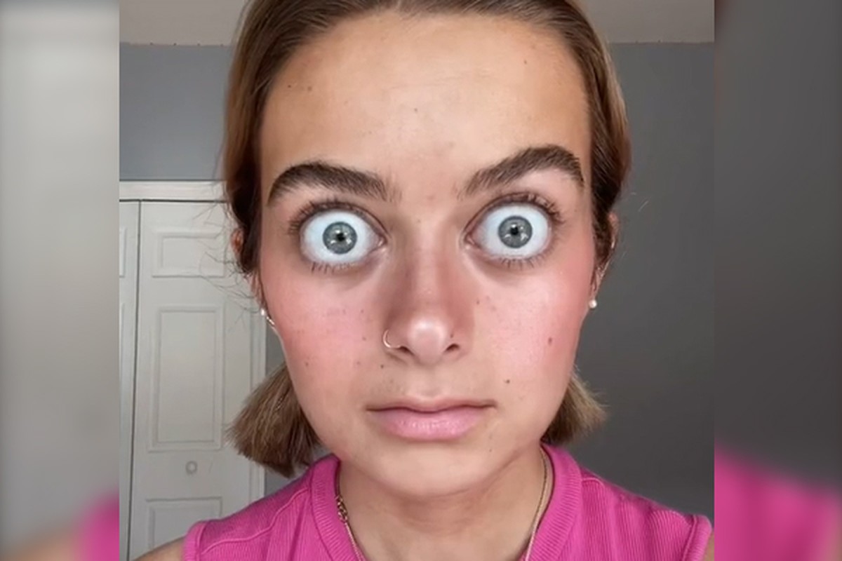 Influencer viraliza por seus olhos enormes: 'Personagem do Tim Burton'