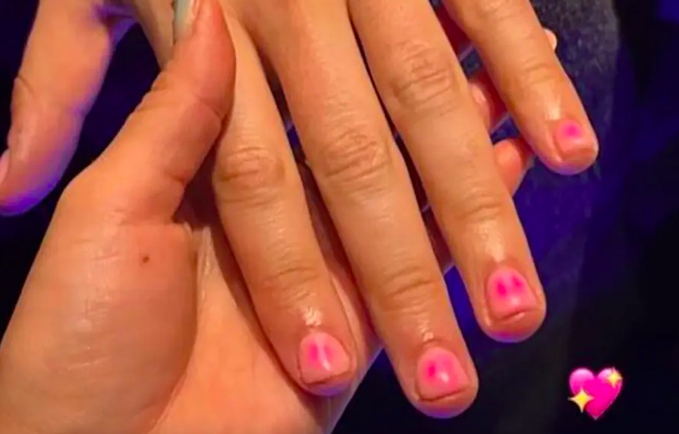 Drake rebate críticas após pintar unhas de rosa para parar de roer: 'O ...