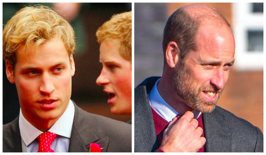 Príncipe William faz piadas sobre sua própria calvície e Kate Middleton ...