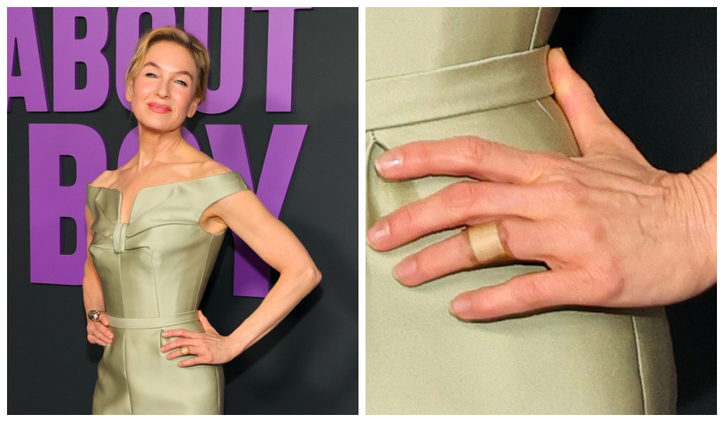 Renée Zellweger usa curativo para deixar dúvida sobre aliança em red ...