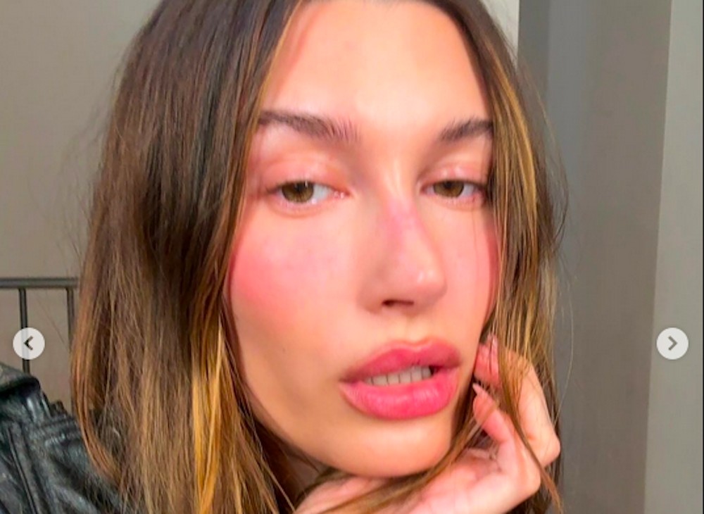 Hailey e Justin Bieber evitam ficar no mesmo cômodo em casa e crise é a pior do casamento até ...