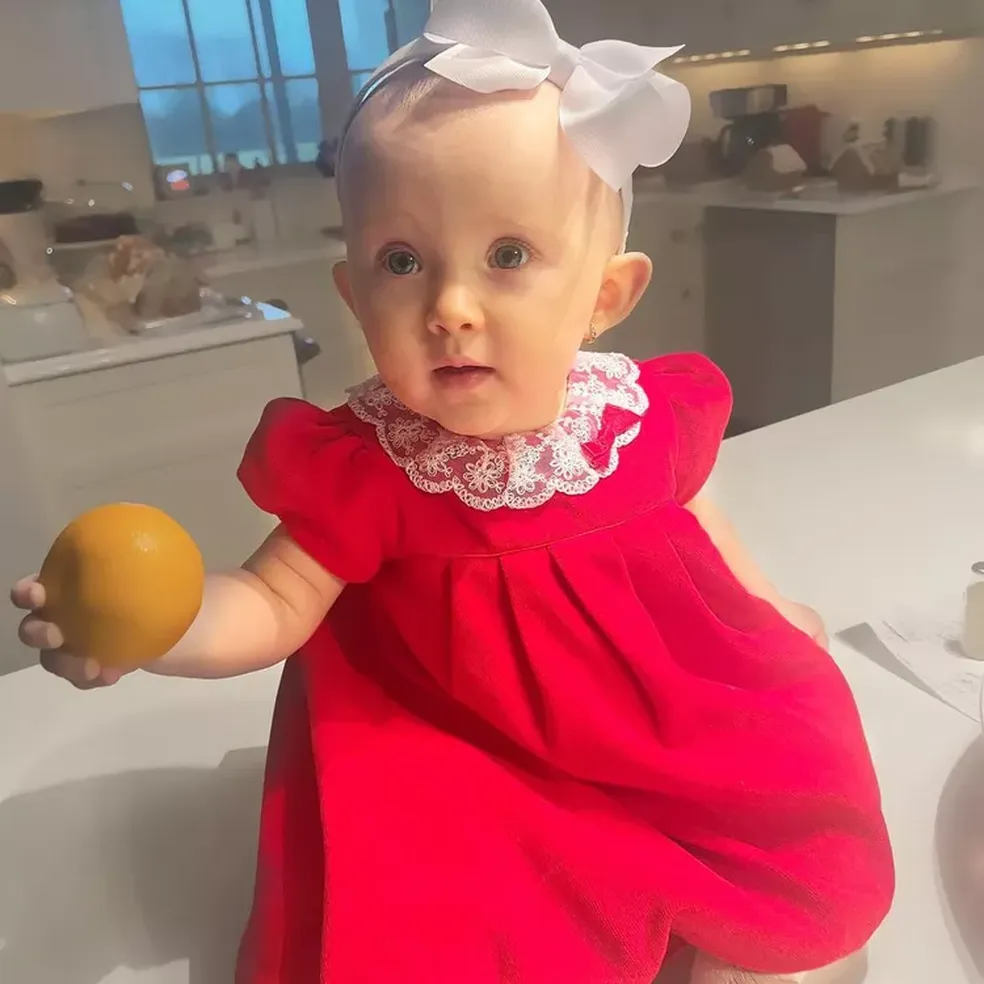 Esposa de Alec Baldwin preocupa fãs ao mostrar olho roxo da filha de um ...