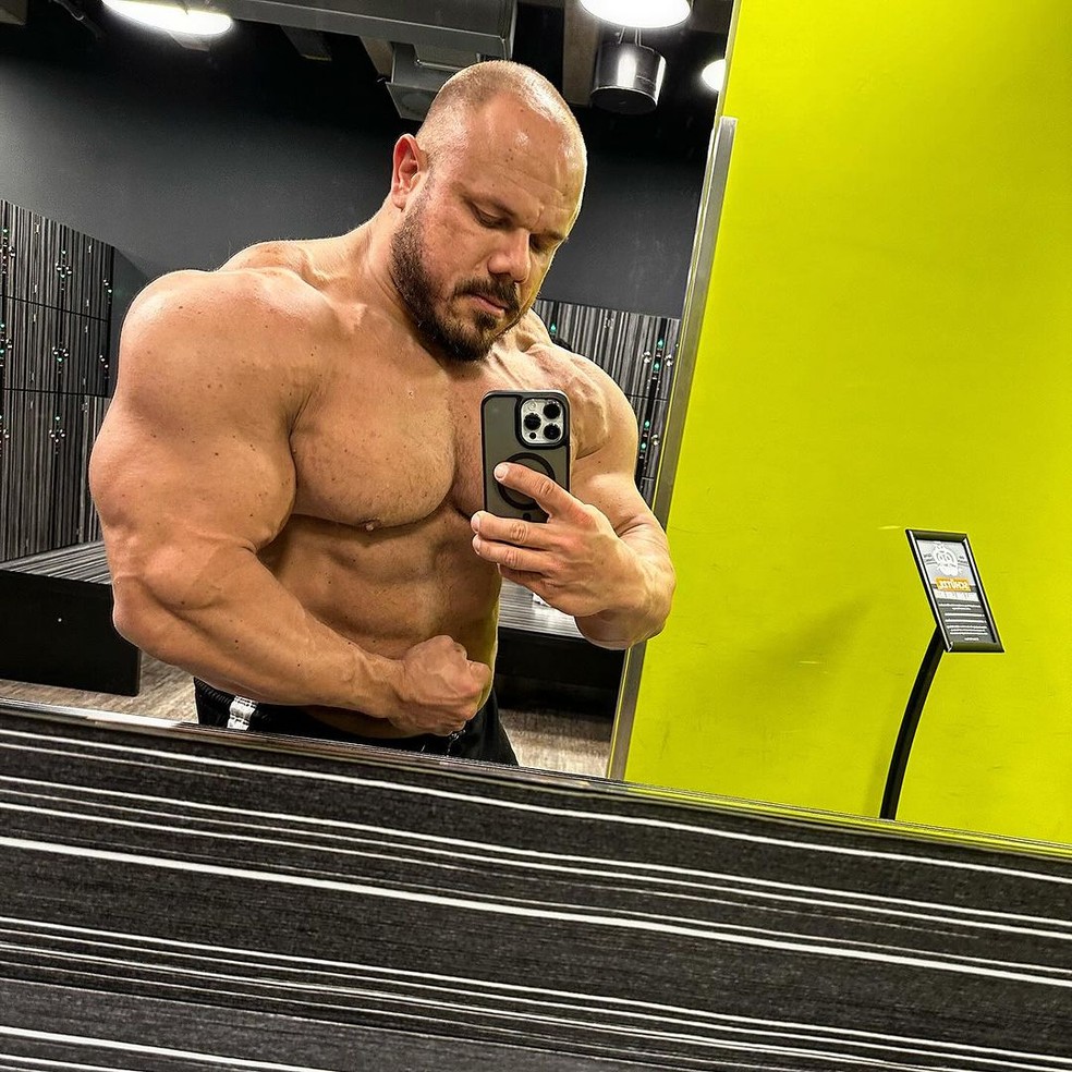 Fisiculturista morre aos 31 anos após cirurgia no joelho e causa comoção