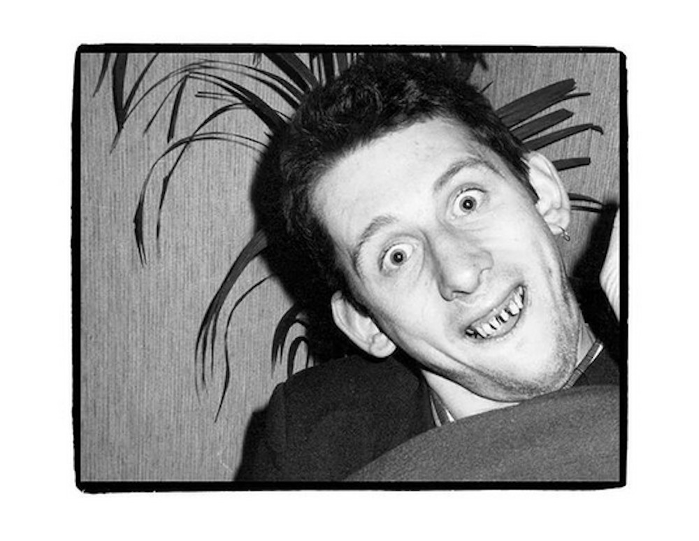 Esposa choca ao mostrar fotos de astro do rock internado por causa de ...